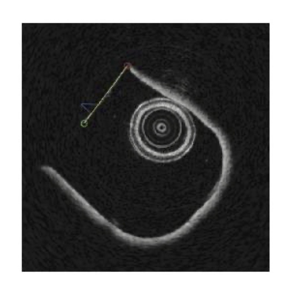Investigating Curvature Induced Circumferential Drifts To Improve The 3d Reconstruction Of A